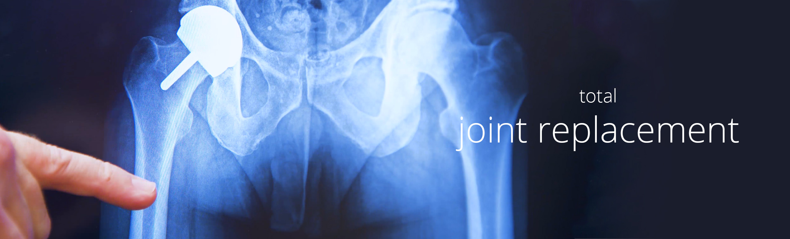 Orthopaedic and Hip Surgery | Florida Medical Clinic